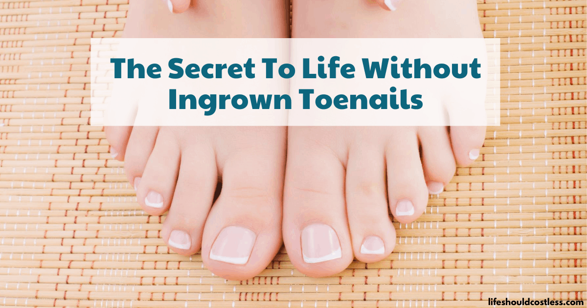 The Secret To Life Without Ingrown Toenails - Life Should Cost Less